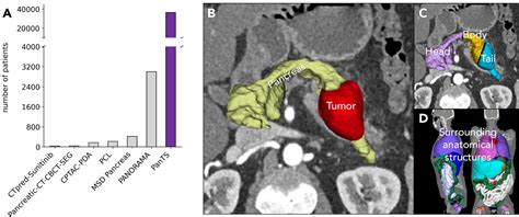 Pants The Pancreatic Tumor Segmentation Dataset