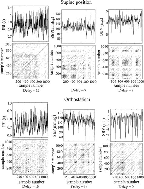 Time Series And Recurrence Plots From Subject Number 8 Ibi Interbeat