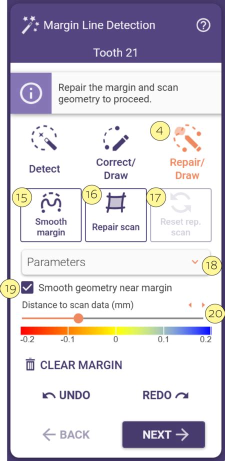 Detect Edit Margins Exocad