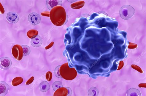 Parvovirus B19 Infection Illustration Stock Image F0425766