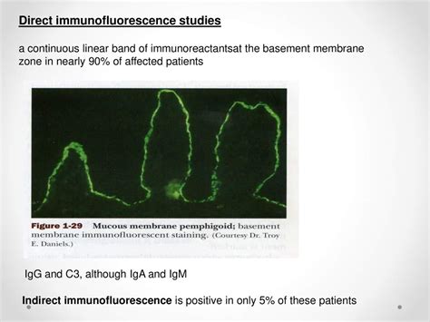 Pemphigoid Ppt Download