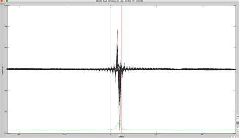 Important Stimulation Artifact In Eeg Recordings Discussions Brainstorm