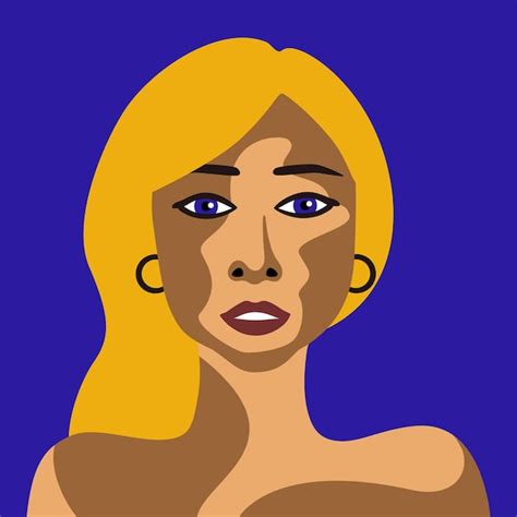 Premium Vector Young Woman With Skin Disease Vitiligo With European