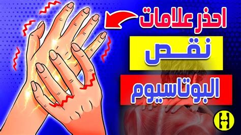 تحذير أعراض نقص البوتاسيوم التي لا يمكن تجاهلها وكيفية التعامل معها