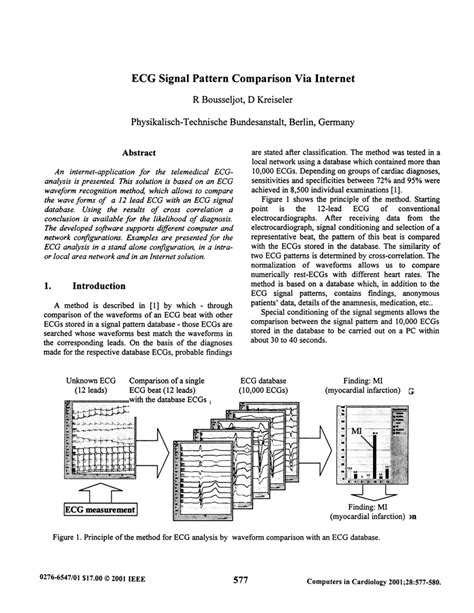Pdf Ecg Signal Pattern Comparison Via Internet