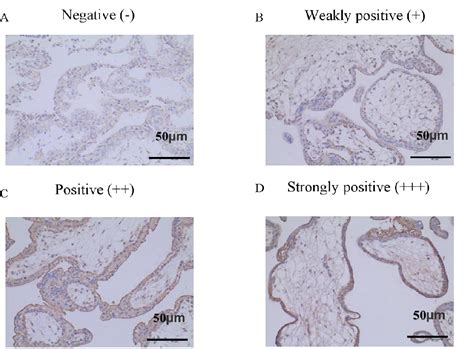 Figure 1 From Expression And Correlation Of Complement C3 And C4 In