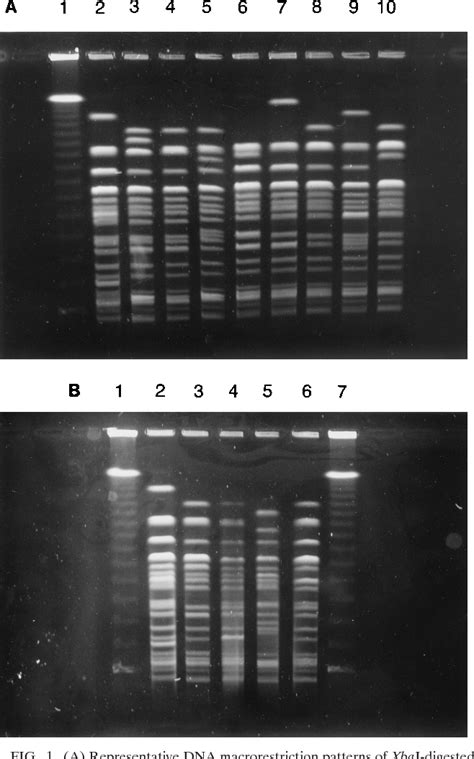 Figure 1 From Epidemiologic Subtyping Of Escherichia Coli Serogroup