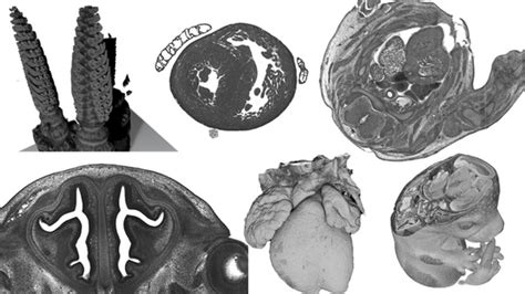Applications For Optical High Resolution Episcopic Microscopy Hrem By Indigo Scientific
