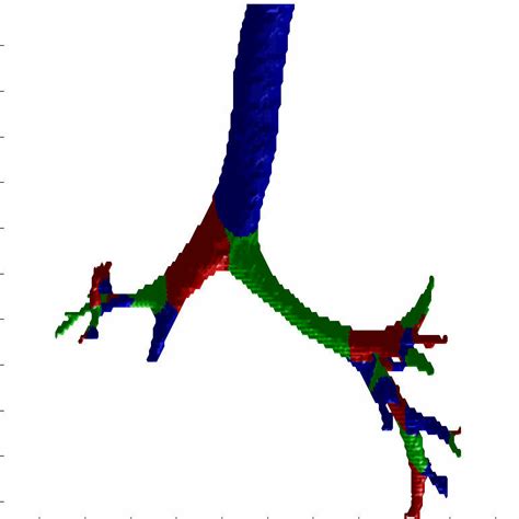 Branch Labelling And Identification Of Obstructed Branch Download Scientific Diagram