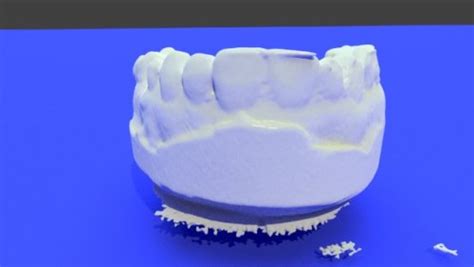 Mf Stl File Processed Dental Orthodontic Maxillofacial