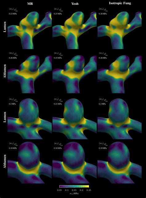 largest principal cauchy stress field at the peak systole σ 1 on the