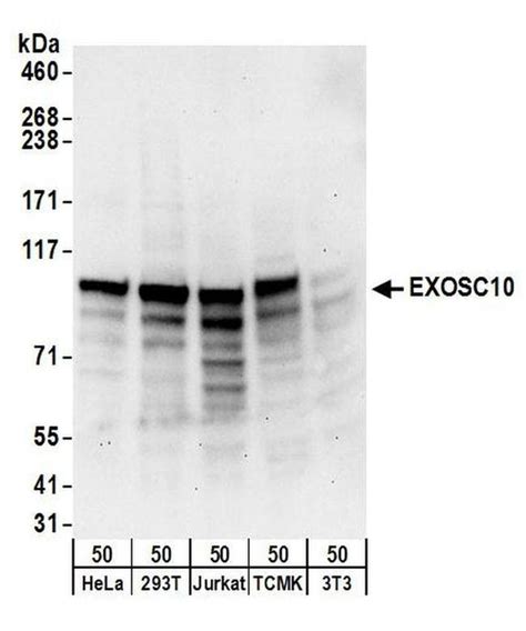 Exosc10 Polyclonal Antibody A303 987a
