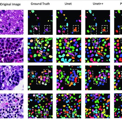 Visualization Results On Four Different Organs Among Unet Unet