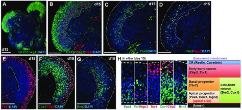 Multi Layered Cortical Ne On Day 15 A Day 15 Aggregate Carrying Download Scientific Diagram