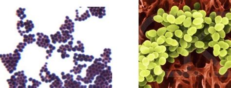 Genus Staphylococcus Flashcards Quizlet