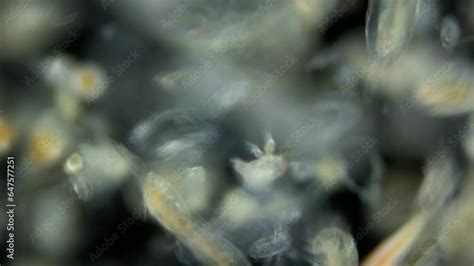 Zooplankton And Plankton Of White Sea Under A Microscope Various Types