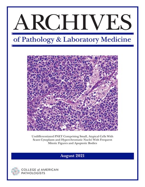 Targeted Next Generation Sequencing Identifies Molecular And Genetic Events In Dedifferentiated