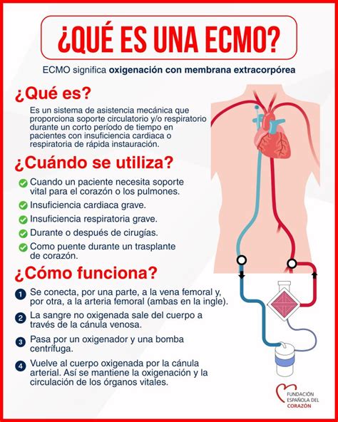 ¿sabes Qué Es Una Ecmo Fundación Española Del Corazón