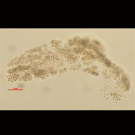 Micrographs Of Cyanobacteria Greenwater Laboratories