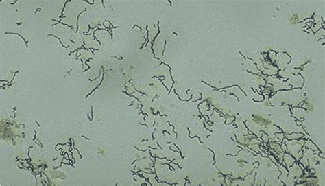 Syphilis Microscopy