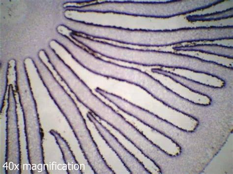 Coprinus Under Microscope