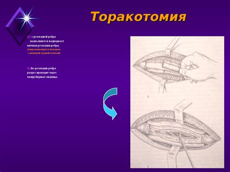 Введение в торакальную хирургию - презентация онлайн