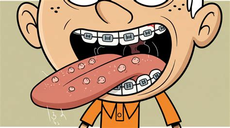Lincoln Loud With Braces Sticking His Tongue Out By