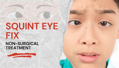 Squint Eye Fix Non Surgical Treatment Options Laxmi Eye Hospital