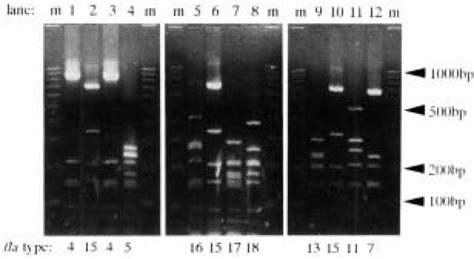 Relp Patterns Of C Jejuni Isolated From Breeders And Broilers M 100