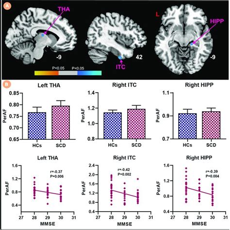 Relationships Between The Gmv And Mmse In Subjective Cognitive Decline Download Scientific