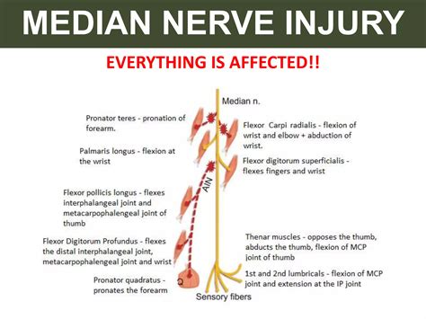 Peripheral Nerve Injuries Pptx