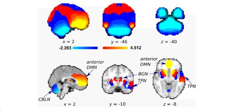 Averaged Unwarping Shift Map Of The Whole Brain Top Used For Field Download Scientific