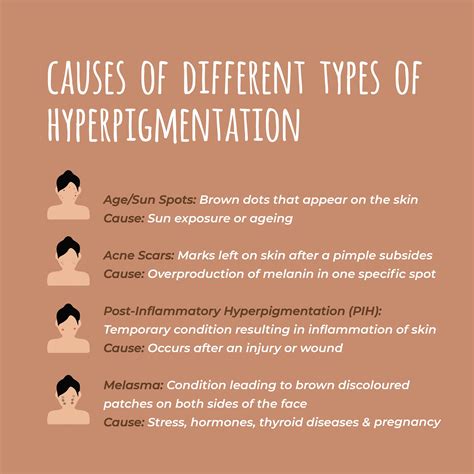 How To Get Rid Of Hyperpigmentation The Dermatologist Approved Way