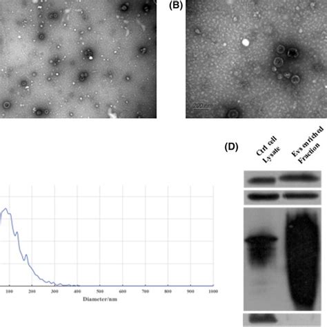 Characterization Of Plasma Extracellular Vesicles A Electron