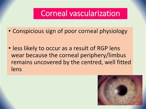 Rgp Complications Pptx Eye And Vision Conditions Diseases And