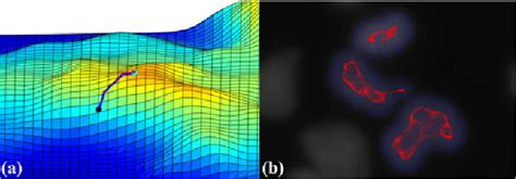 figure 4 from nucleus segmentation using gaussian mixture based shape