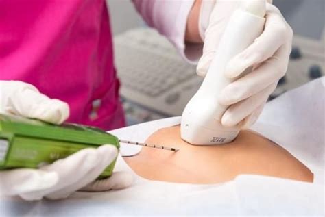 ¿En qué consiste una biopsia y cuándo es necesaria? | Biopsia, Información médica, Salud