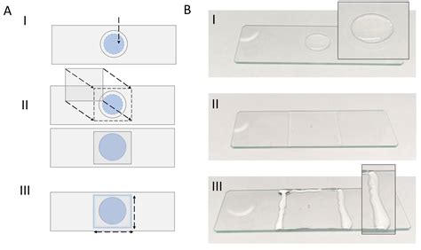 Polarization Sensitive Two Photon Microscopy For A Label Free Amyloid Structural Characterization