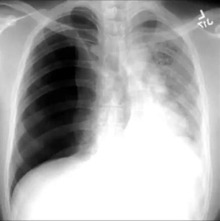 Types Of X Rays Residency Radiology