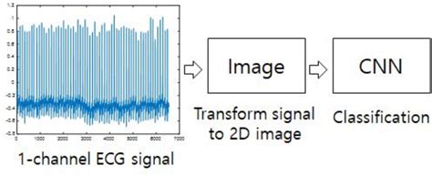 Figure 1 From Biometrics And Healthcare System Using Emg And Ecg