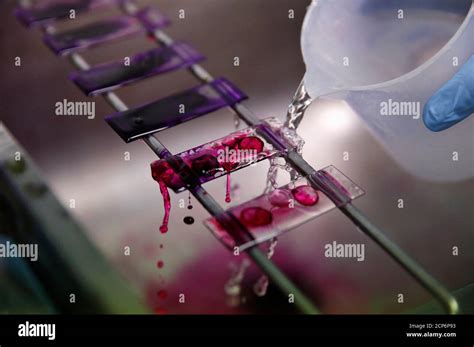 Tb Test Hi Res Stock Photography And Images Alamy