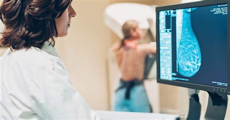 screening mammogram cpt code