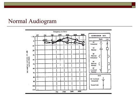 Introduction To Basic Audiology Ppt