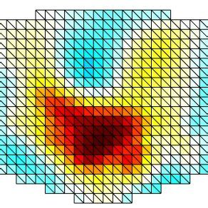A Realistic FEM Based On The Same Surface Model As The Pelvic Download Scientific Diagram