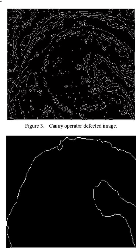 Figure 3 From Multi Scale Edge Detection Of Wood Defect Images Based On The Dyadic Wavelet