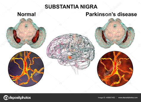 Black Substance Midbrain Its Dopaminergic Neurons Normal State