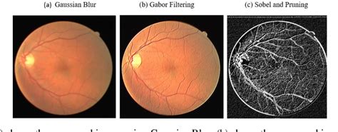 Figure 1 From A Trio Method For Retinal Vessel Segmentation Using Image