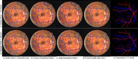 Figure 6 From Fully Automated Tree Topology Estimation And Artery Vein Classification Semantic