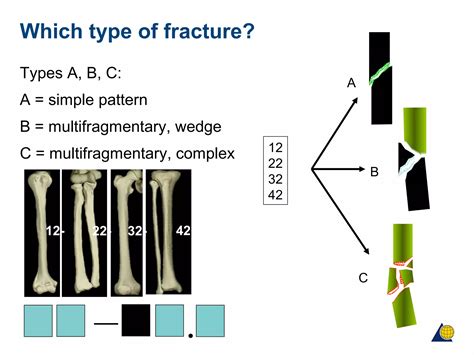 Ao Classification Ppt