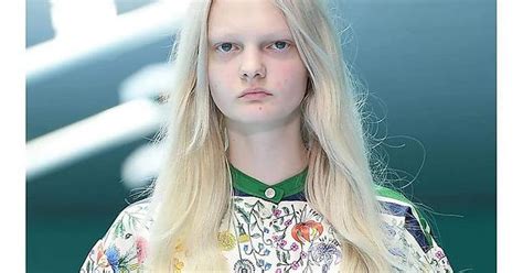 Dump A Pa Looz A Album On Imgur